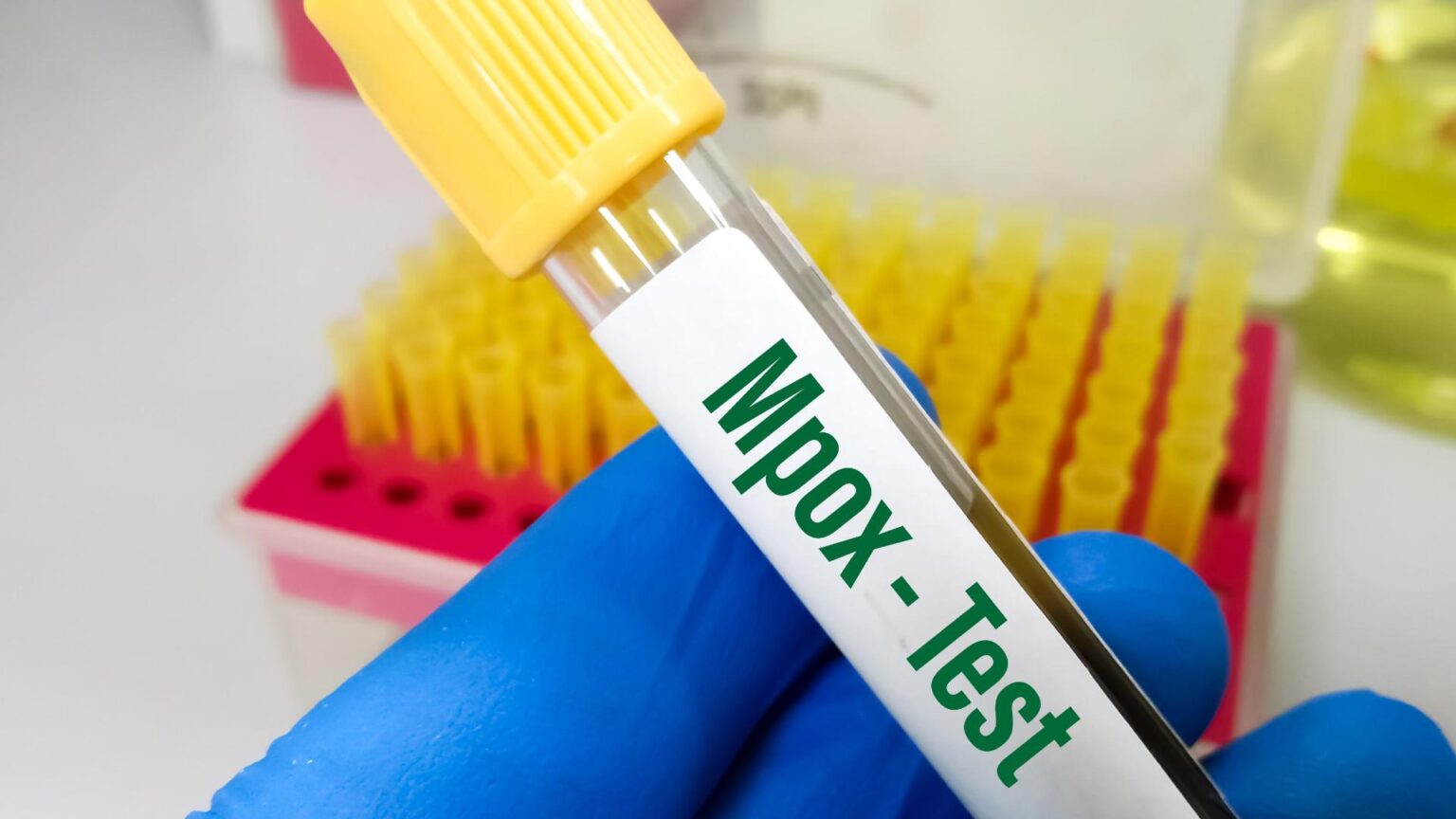 Here's everything you should know about mpox -WHO - TV47 Digital