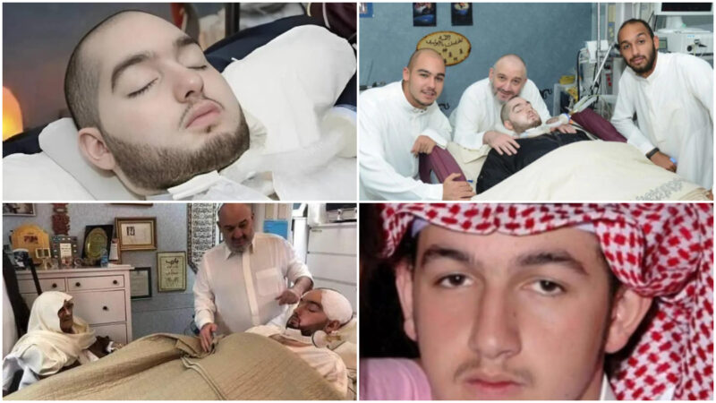 The 'Sleeping Prince', in coma for nearly 20 years, turns 36